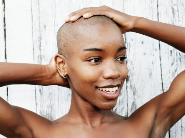 Different Types Of Alopecia and How To Treat Or Cure Them - Reina Haircare